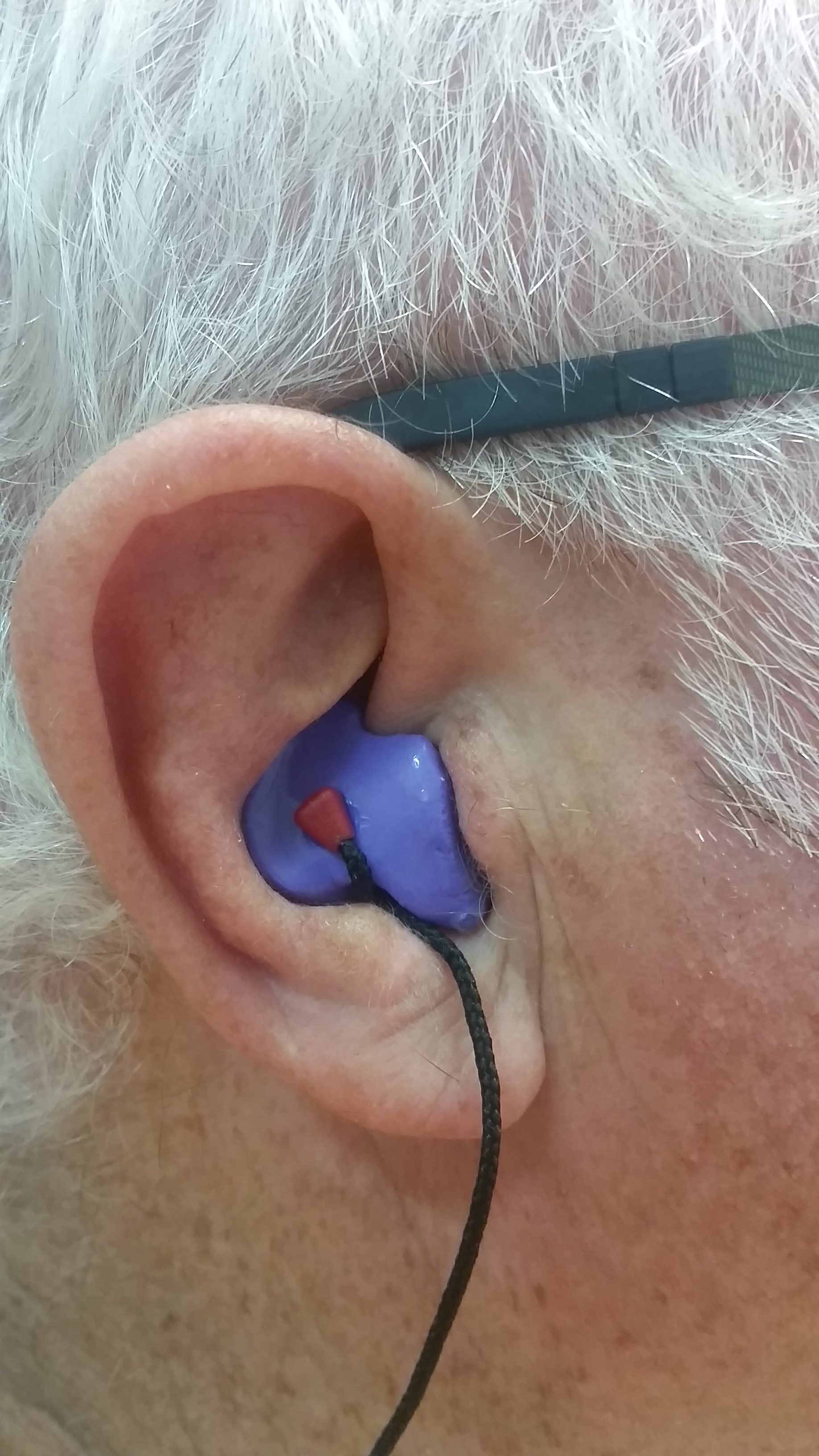 Custom fit molded ear plugs - Timaru Occupational Health Services